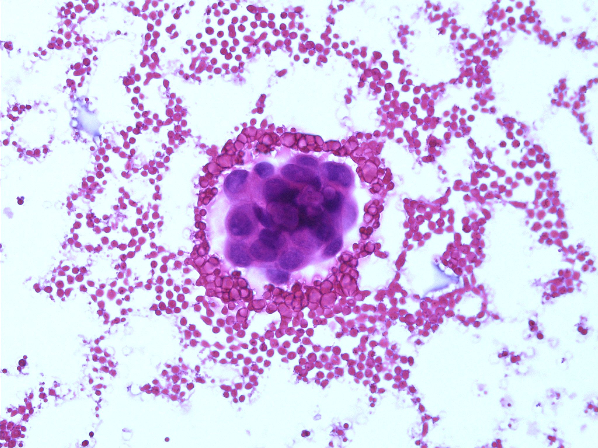 für Interessierte – MVZ für Pathologie des Universitätsklinikums Köln